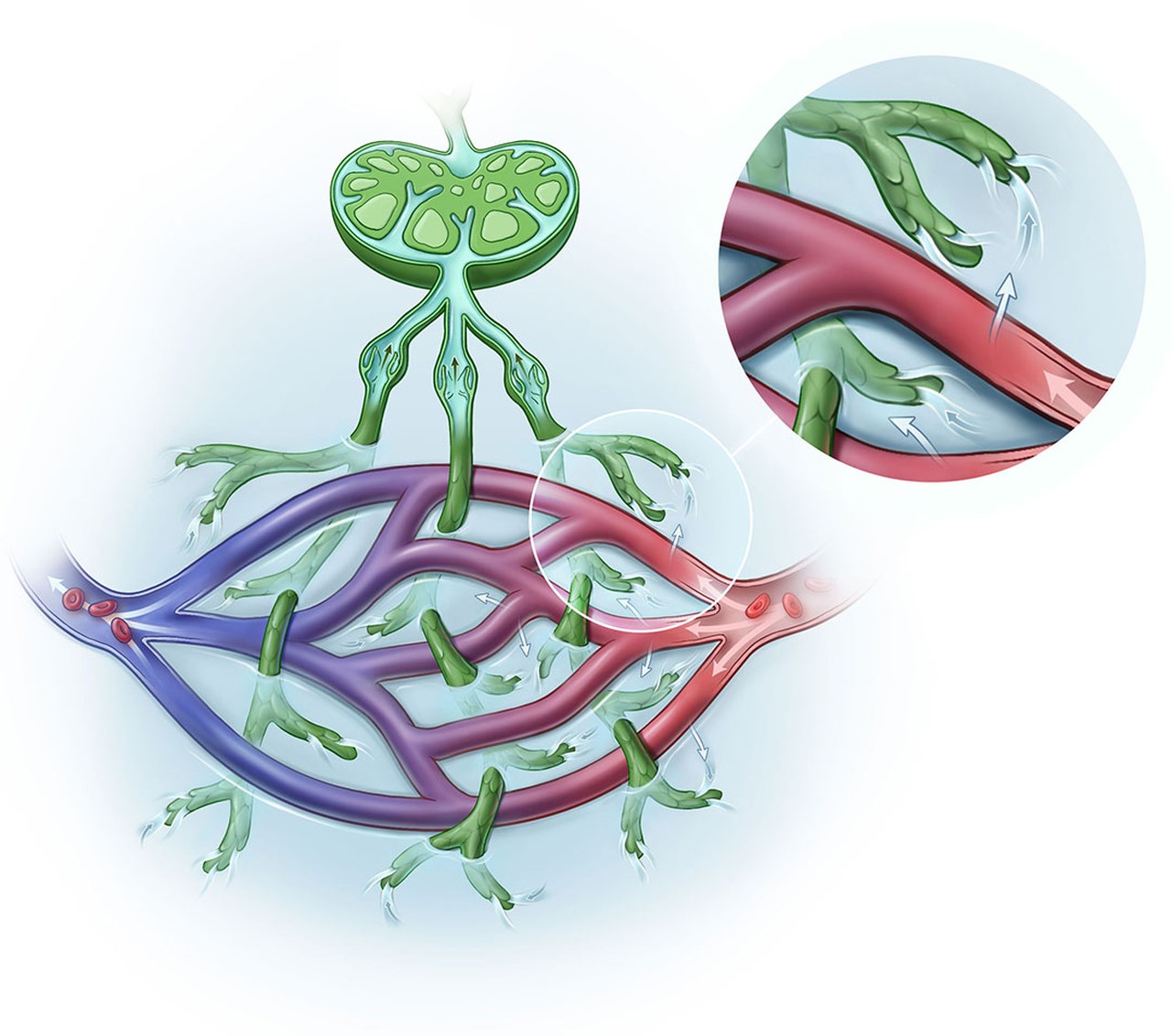 Lymphedema: Why and how compression therapy helps | Sigvaris.com